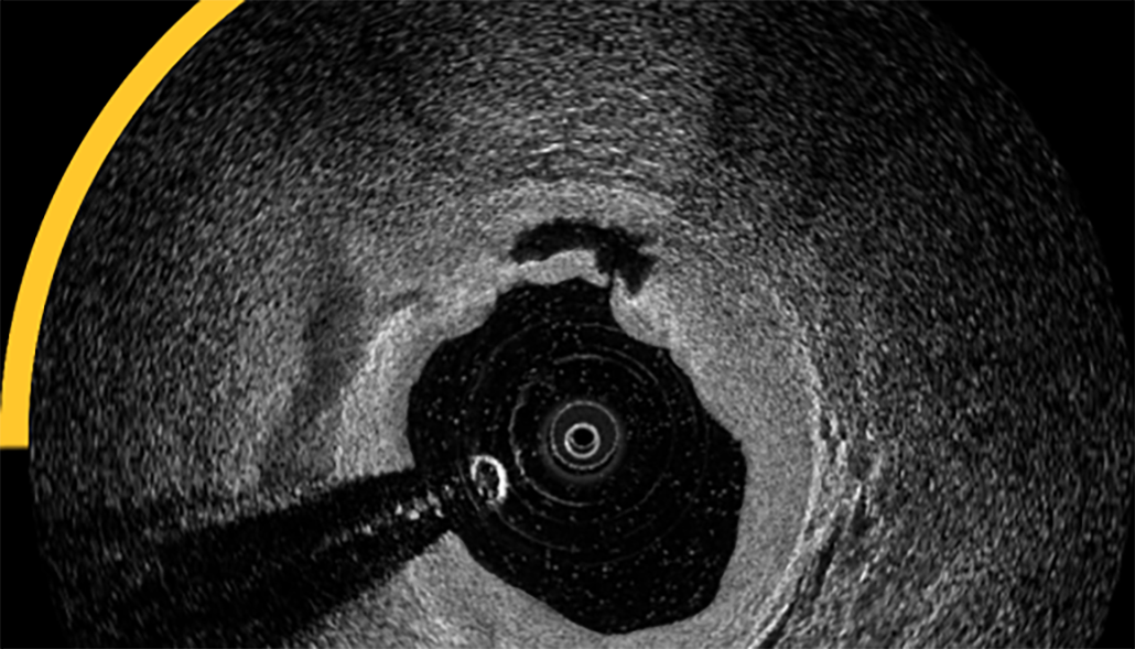 News - SpectraWAVE, Inc.