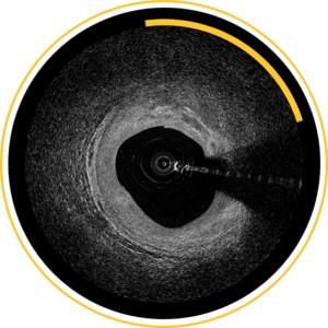 SpectraWAVE, Inc. | Medical Imaging | United States