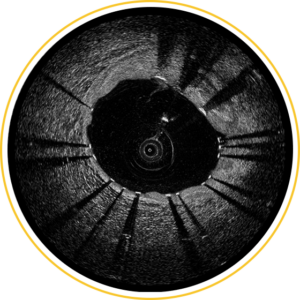 SpectraWAVE, Inc. | Medical Imaging | United States