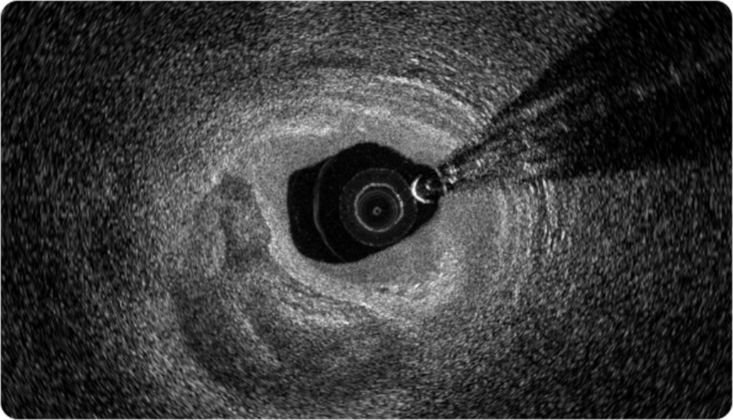 SpectraWAVE Announces $13.2 Million Series A-2 Financing from Existing ...