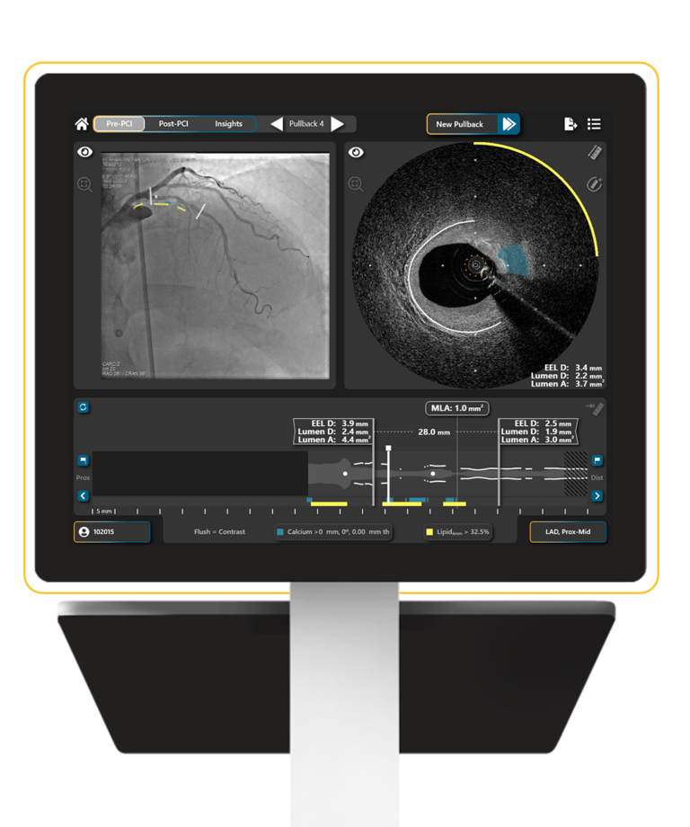 SpectraWAVE, Inc. | Medical Imaging | United States