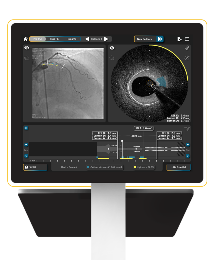 SpectraWAVE, Inc. | Medical Imaging | United States