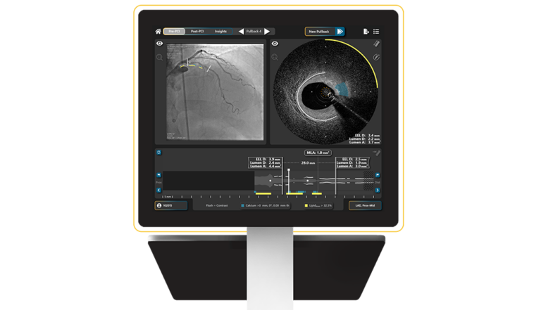 News - SpectraWAVE, Inc.