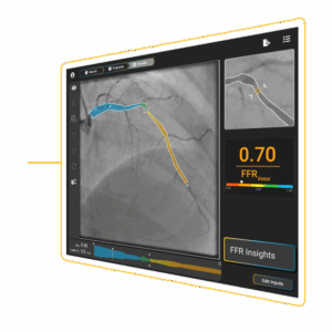 SpectraWAVE, Inc. | Medical Imaging | United States