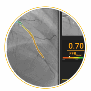 SpectraWAVE, Inc. | Medical Imaging | United States