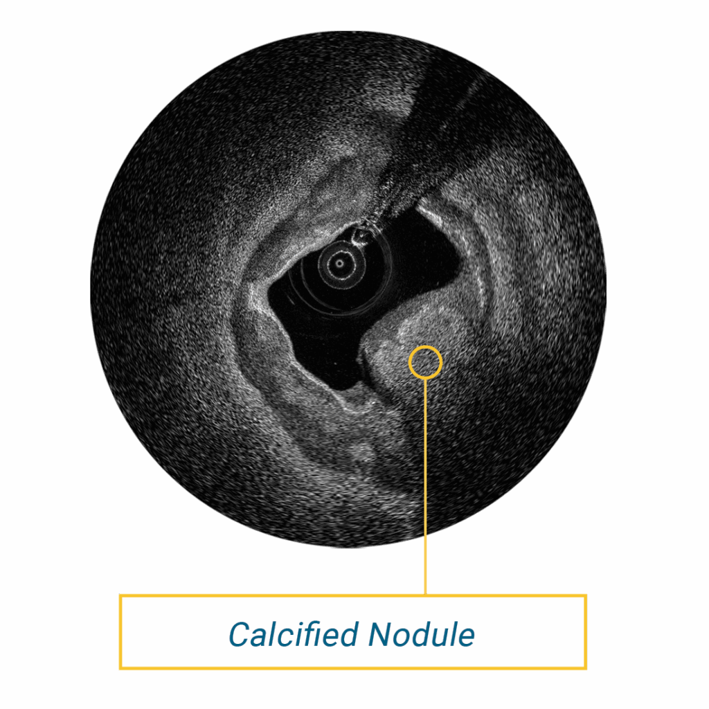 Product - SpectraWAVE, Inc.