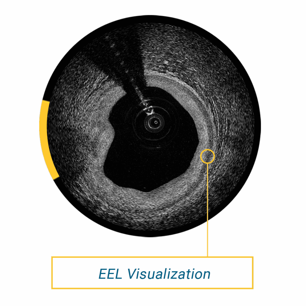 Product - SpectraWAVE, Inc.