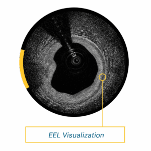 Product - SpectraWAVE, Inc.