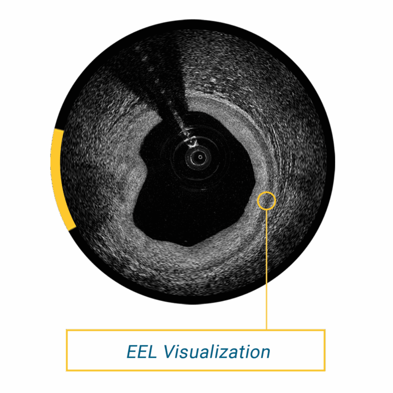 Product - SpectraWAVE, Inc.