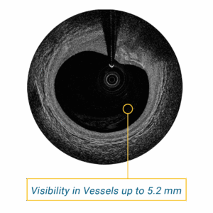 Product - SpectraWAVE, Inc.