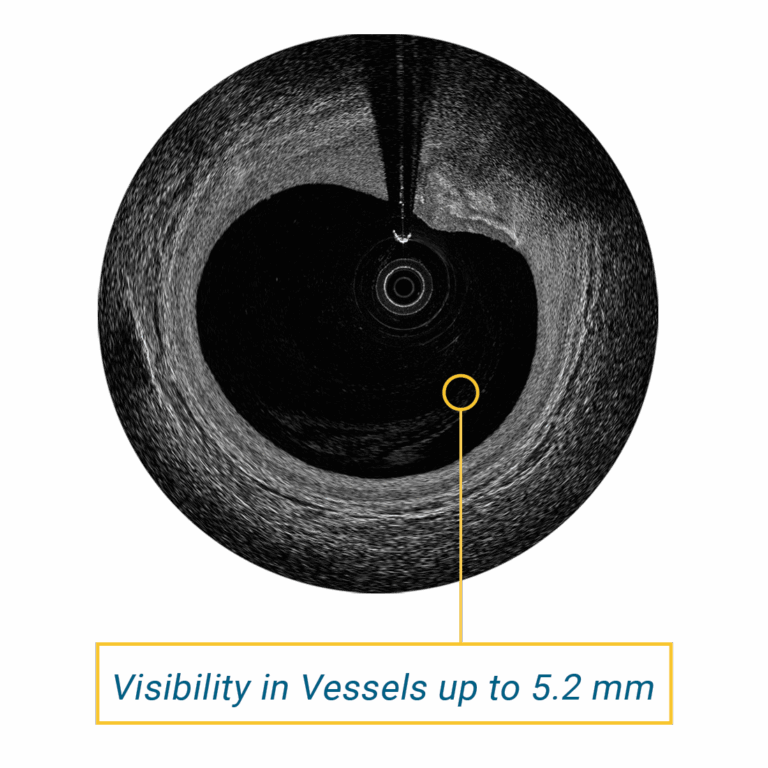 Product - SpectraWAVE, Inc.