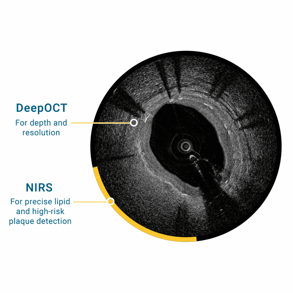 Product - SpectraWAVE, Inc.