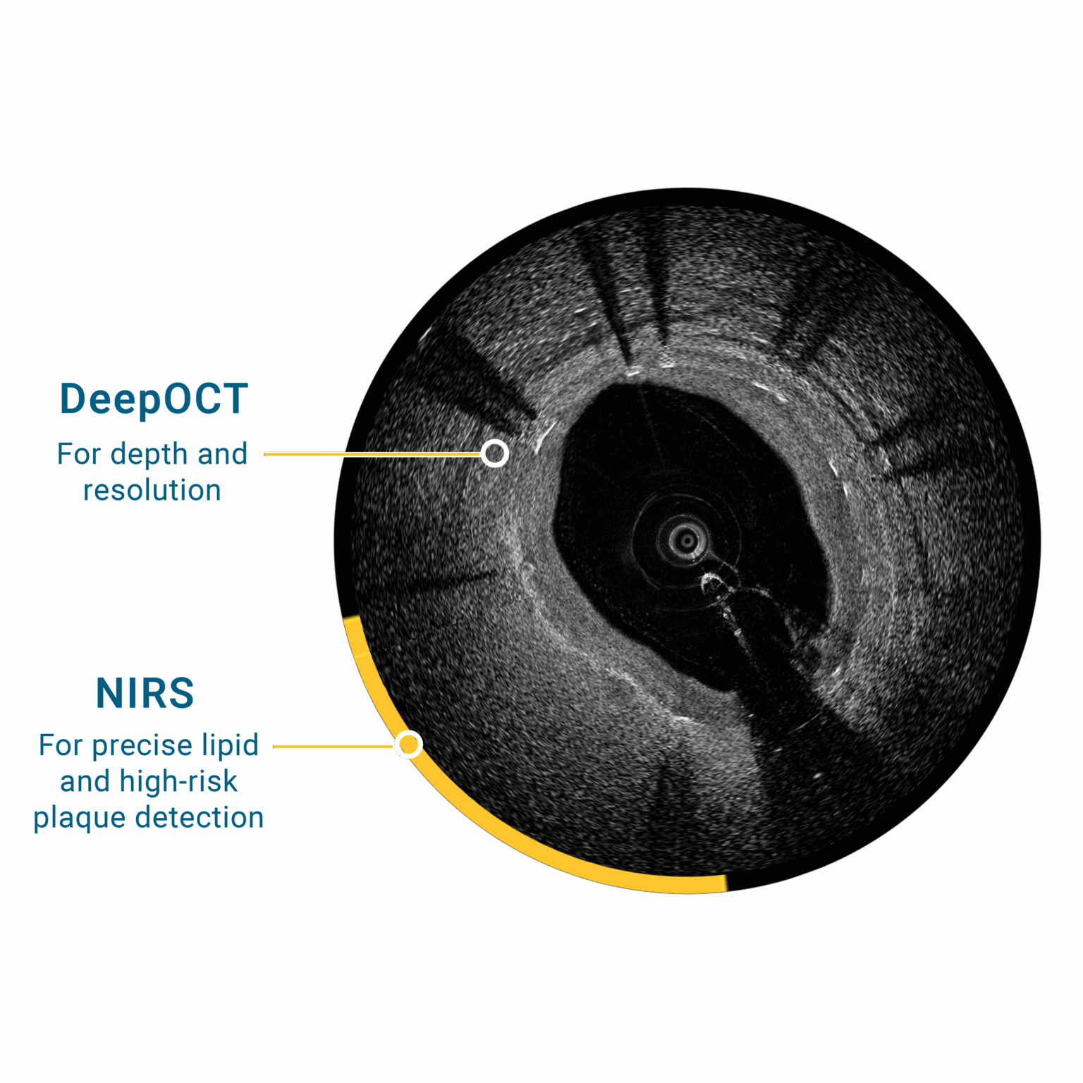 Product - SpectraWAVE, Inc.