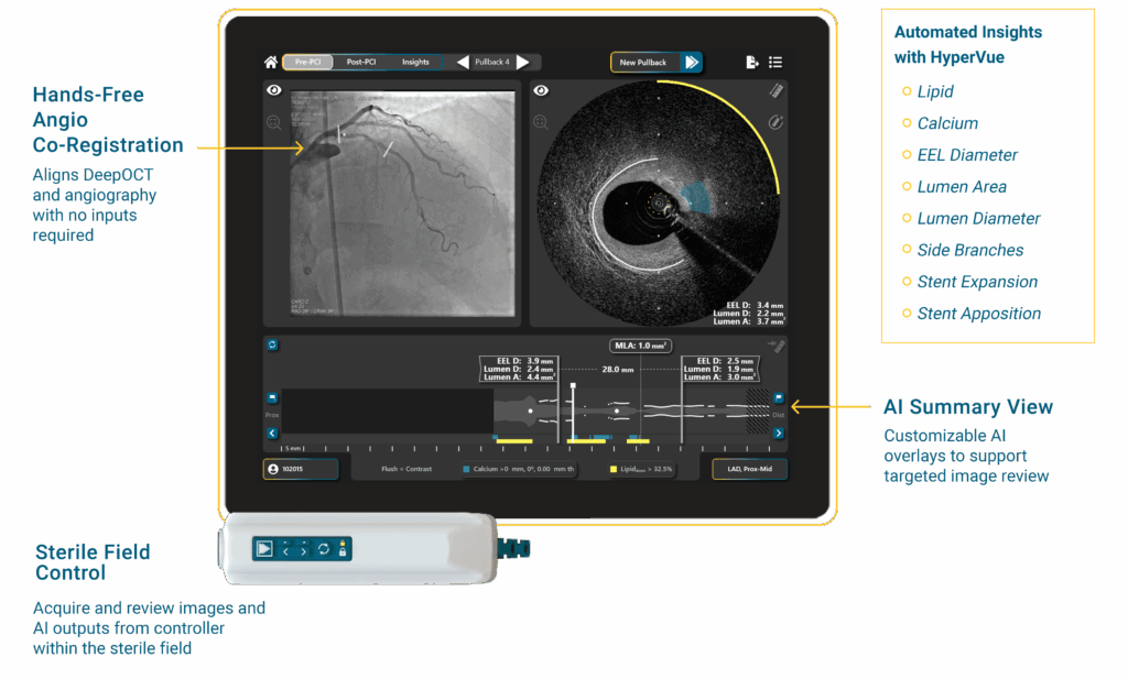 Product - SpectraWAVE, Inc.