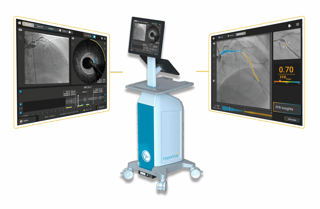 SpectraWAVE, Inc. | Medical Imaging | United States