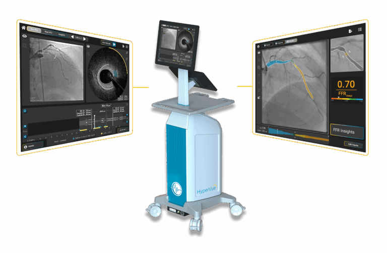 SpectraWAVE, Inc. | Medical Imaging | United States